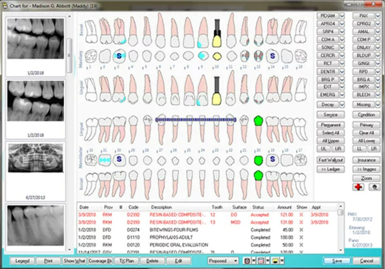 Best Dental Software Comparison & Reviews 2023
